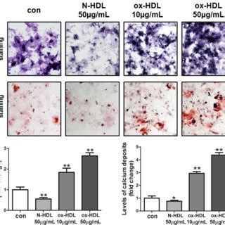 Effects Of Ox HDL On Calcification Related Gene Expression In AVICs