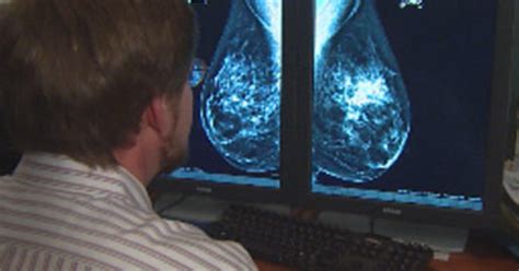 Do You Know What A Baseline Mammogram Is Its Important You Do Cbs