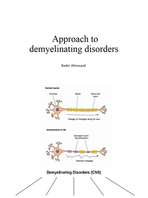 Approach To Demyelinating Disorders Pdf Multiple Sclerosis Human