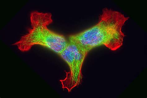 Human Epithelial Cells Triple Stained Nikon Small World