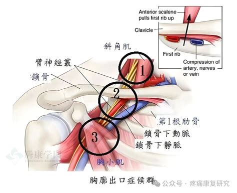 几乎所有可引起手麻的疾病都在这里了 MedSci cn