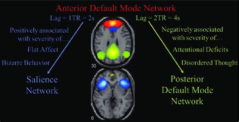 Disrupted Anterior Default Mode Network Functional Communication Linked Download Scientific