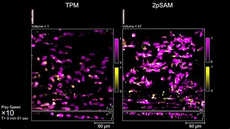 Cell Two Photon Synthetic Aperture Microscopy For Cross Scale