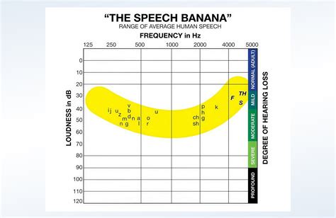 What Is The Speech Banana In Hearing