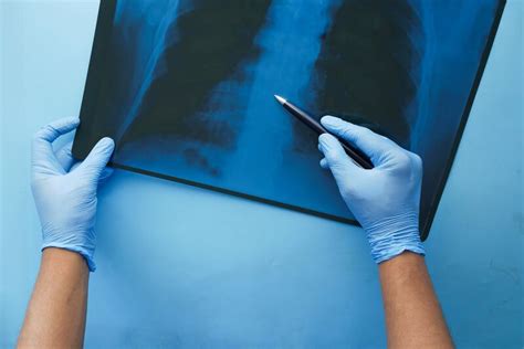 Kreeger Law Firm On Linkedin Catastrophic Injuries Can Affect You For