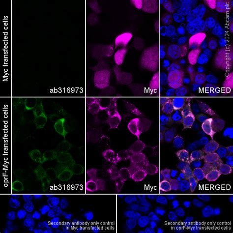 Anti Pseudomonas Outer Membrane Porin F Antibody [epr28629 91