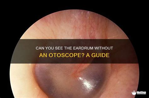 Can You See The Eardrum Without An Otoscope A Guide Medshun
