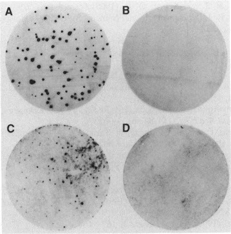 Plaque Hybridization Of Phage Cdna Libraries Phage Lambda Libraries Download Scientific