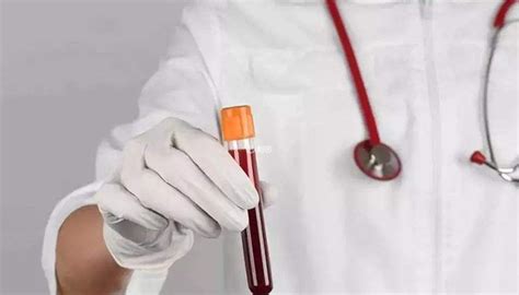 唐筛高风险的骗局分析不妨先看过来人说太坑人的真实原因 相因宝贝