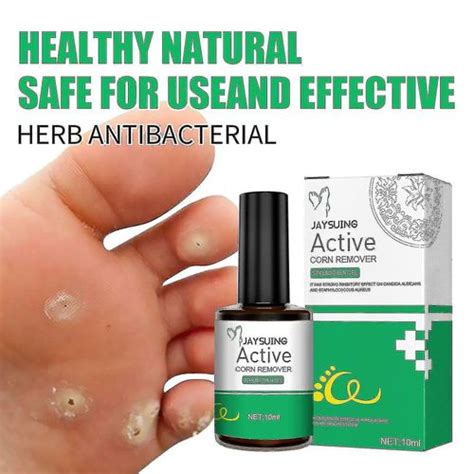 Jaysuing Remove Wart Remove Corns Mild And No Burning Gram Warts Remove