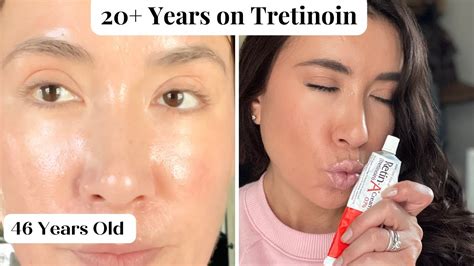 Tretinoin The Best Topical Anti Aging Cream See My Skin And What Ive