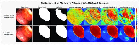 The Attention Visualization Comparison Attention Gated Network Vs Download Scientific Diagram