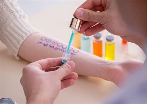 Topic 1 Common Food Allergy Symptoms E Safe Project