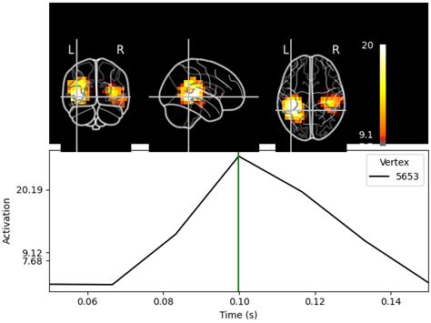 Visualize Source Time Courses Stcs — Mne 1100 Documentation