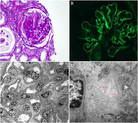 A Light Microscopy Shows The Cellular Crescent Formation And Vacuolar