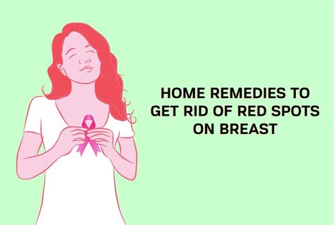 Red Spot On Breast Looks Like Hickey Treatment And Home Remedies Learn
