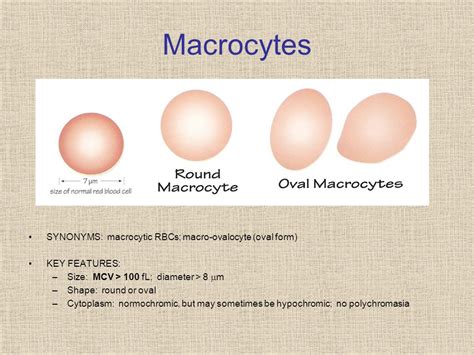 Red Cell Morphology Basic Introduction Reference Color Atlas Of