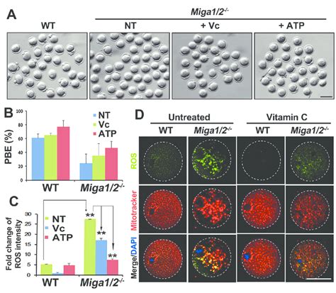 Vitamin C Partially Reverses Mitochondrial Defects In Miga12