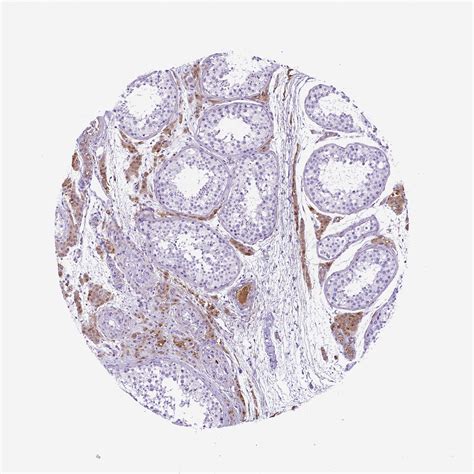 Tissue Expression Of Apoe Staining In Testis The Human Protein Atlas