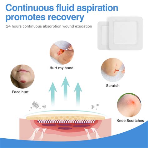 Self Adhesive Foam Dressing Guangdong Southvo Medical Technology Coltd