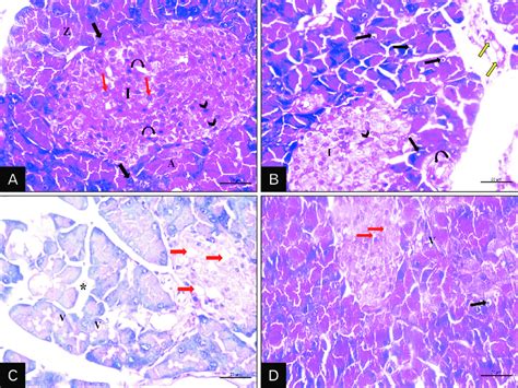 Representative Hande Staining Of Rat Pancreas A Control Group