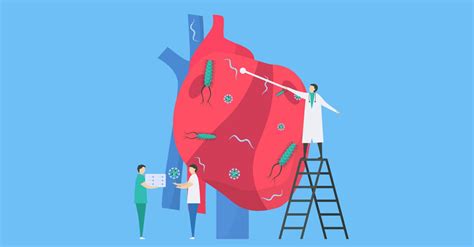 Uk To Review Guidelines On Infective Endocarditis Prevention