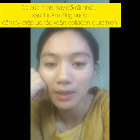 Tâm Sự Về Da Xíu Nha Mọi Người 👉lười Dùng Mỹ Phẩm 👉lười Uống Nước