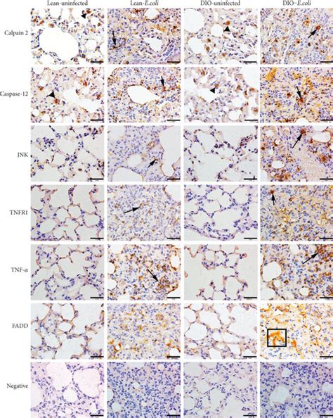 Representative Immunohistochemistry Staining Of Apoptotic Proteins