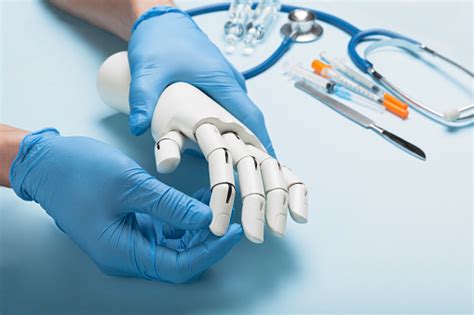 병원에서 의사에 보 철 손입니다 인공 사지 아픔에 대한 스톡 사진 및 기타 이미지 아픔 절단 수술을 받은 사람 건강관리와