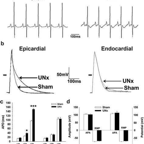 Prolongation Of Corrected Qt Interval And Action Potential Duration In