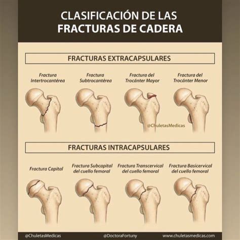 An Image Of The Different Types Of Knee Bones In Spanish And English
