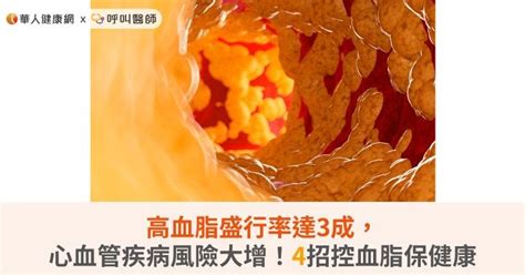 高血脂盛行率達3成，心血管疾病風險大增！「控脂4招」保健康 蕃新聞