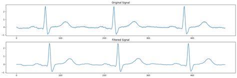 Github Pahansith Ecg Arrythmia Detection This Is A Project I