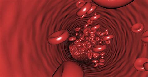 Arteriosklerosis Gejala Penyebab Dan Pengobatan Hello Sehat