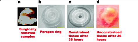 Visual Comparisons Between Constrained And Unconstrained Disc Tissue A