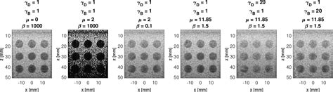 A Unifying Approach To Ultrasound Beamforming And Deconvolution Using Admm