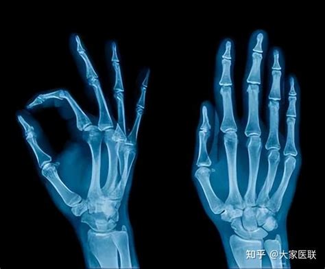 Ct、核磁、b超的区别，讲的太到位了 知乎