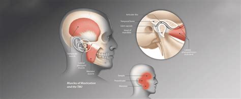 How To Treat Tmj Disorder With Mewing Is It Possible Ach