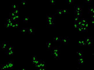 抗双链DNAdsDNA抗体检测试剂盒 北京和杰创新生物医学科技有限公司