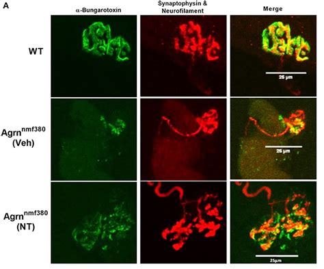 New Publication Modulation Of The Acetylcholine Receptor Clustering Pathway Improves
