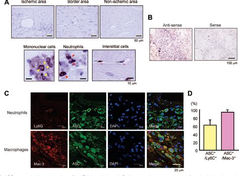 Figure 2 From Inflammasome Activation Of Cardiac Fibroblasts Is