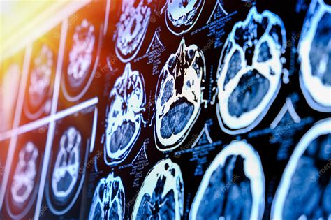 뇌 의학 과학 및 교육 Mri 뇌 배경으로 Ct 스캔 확대 프리미엄 사진
