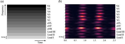 Time Frequency Feature Map A Mimetic Diagram Of The Time Frequency