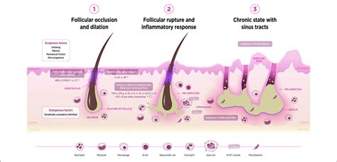 Schematic Diagram To Illustrate Postulated Sequence Of Events Download Scientific Diagram