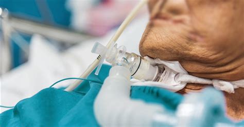 Tracheostomy Complications Short And Long Term