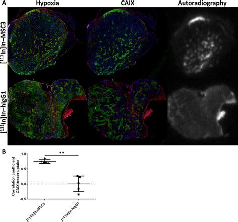 111 In In MSC3 Specifically Accumulates In CAIX Tumor Areas In