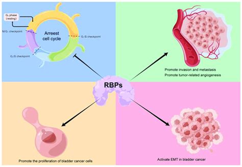 Rbps And Bladder Cancer Various Rbps Promote Bladder Cancer