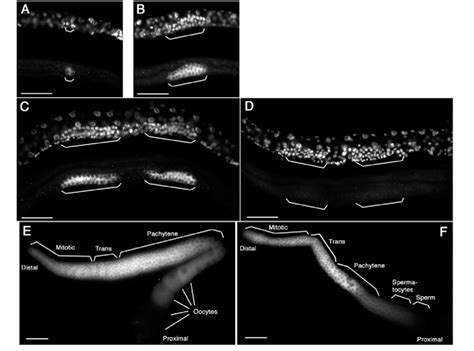 Germline Expression Of Fog 2 During C Elegans Development A D Dapi Download Scientific