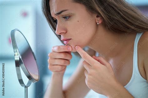 Upset Stressed Sad Acne Woman With Problem Skin Squeezes Pimple At Home