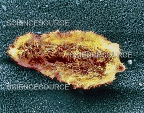 Colored Sem Of Miracidium Of Schistoso Stock Image Science Source